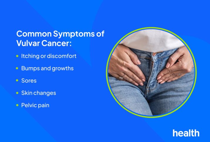 Understanding Vulvar Cancer: Symptoms, Causes, And Diagnosis