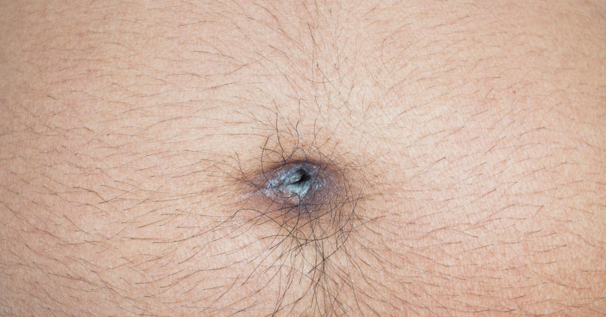 Top 5 Dirty Parts Of The Human Body You Forget To Wash 2024